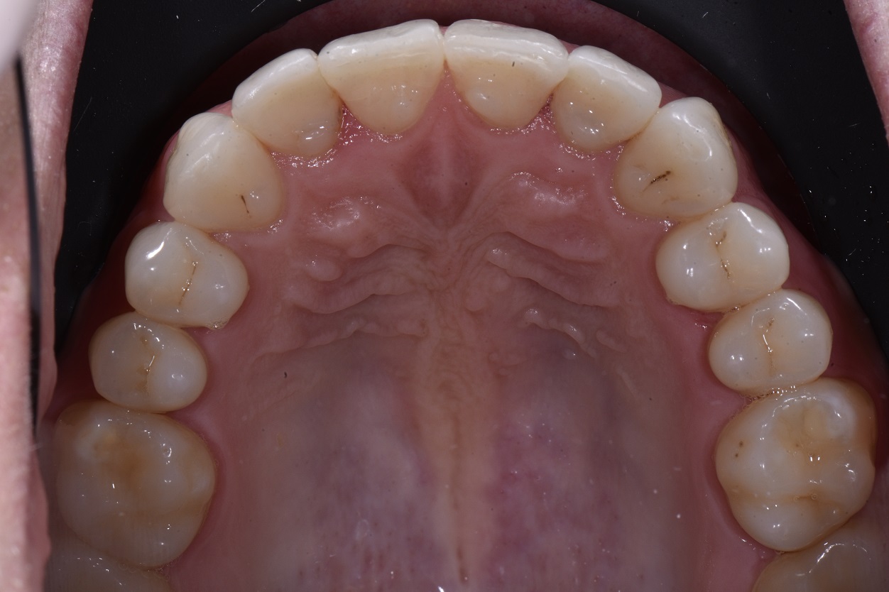 Invisalign | Braces | Bleach | Bonding | Minimally Invasive Cosmetic ...