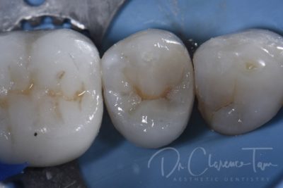 Style Italiano Composite in Action