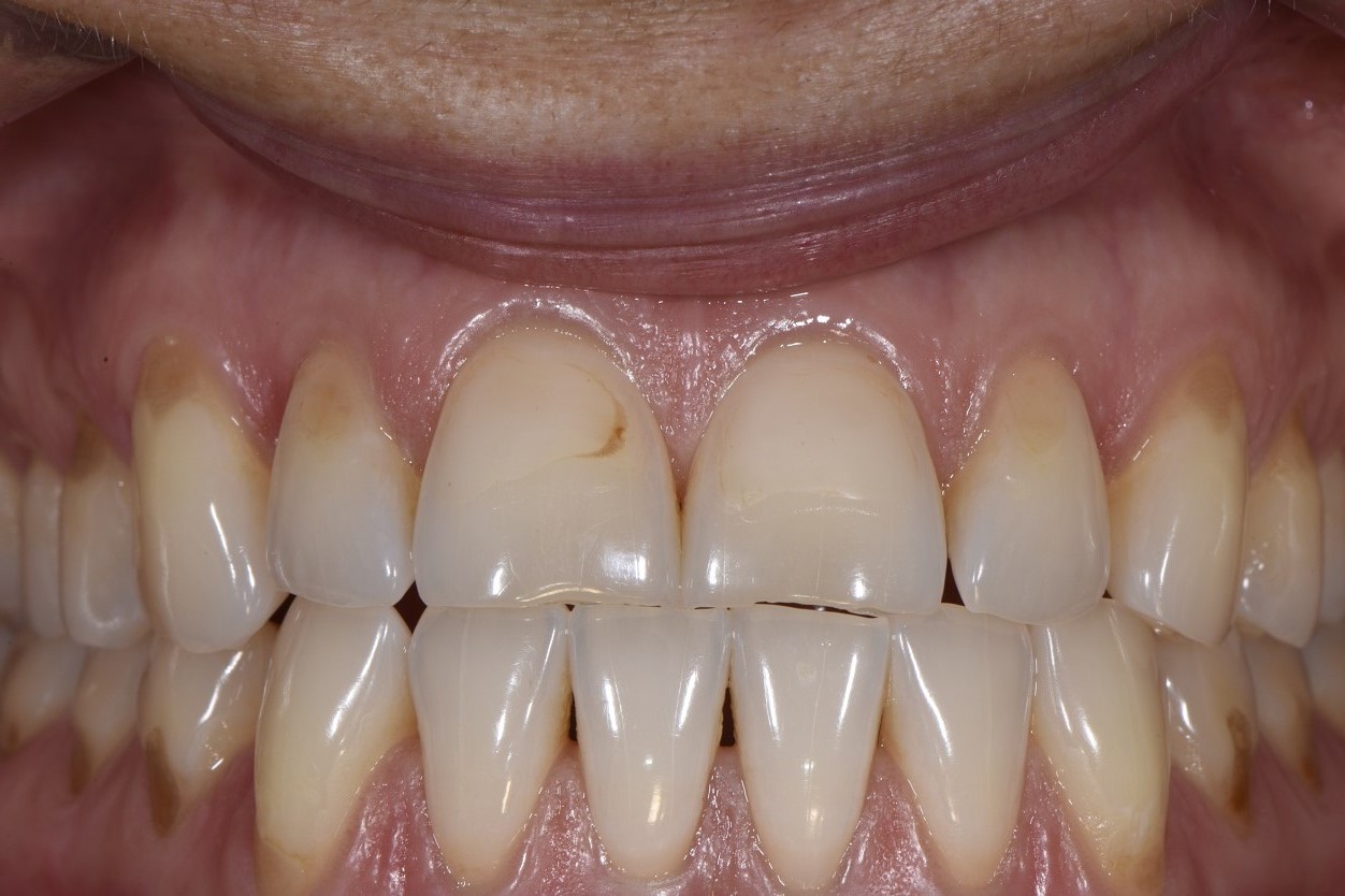 Getting Smiles Wedding Ready