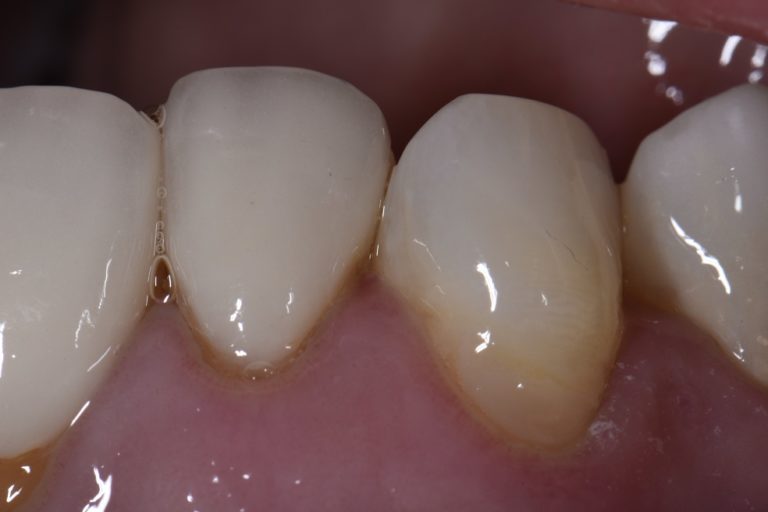 Modifying the Pink before Executing the White