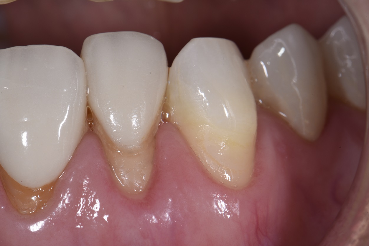 Modifying the Pink before Executing the White