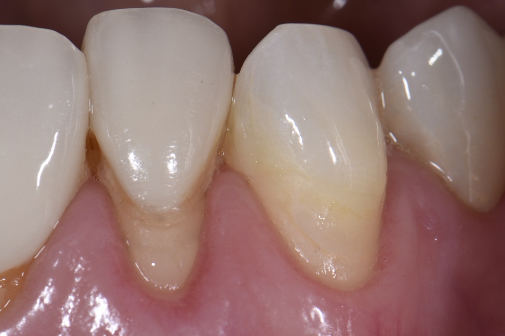 Modifying the Pink before Executing the White