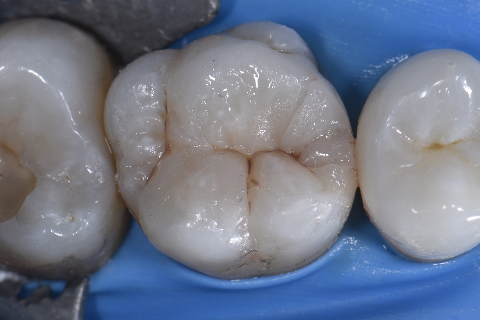 Bioactive Biomimetic Dentistry