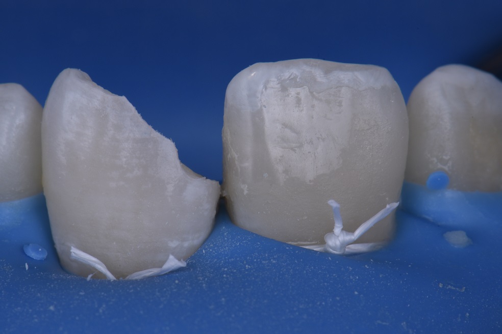 GC Prototype Class IV composite