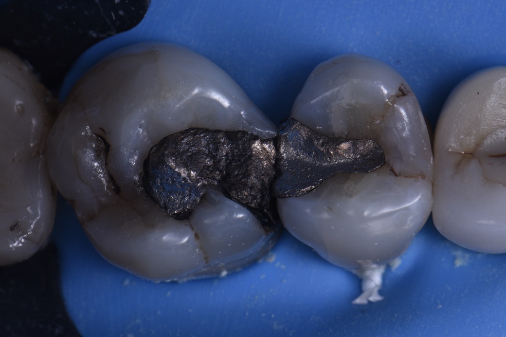 Difficult patient access and interesting composite anatomy