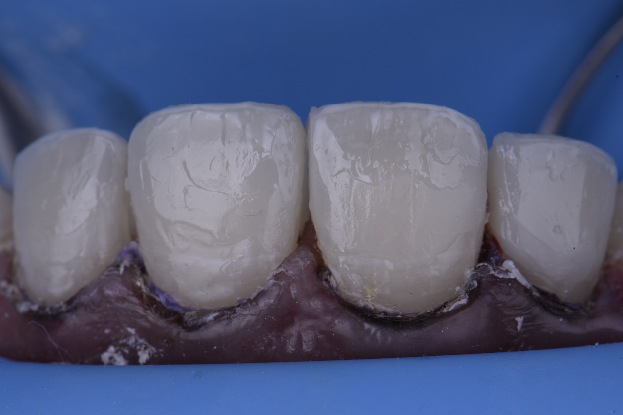 Ultradent Gemini | Ultradent Mosaic | Hu-Friedy Akroflex | Composite ...