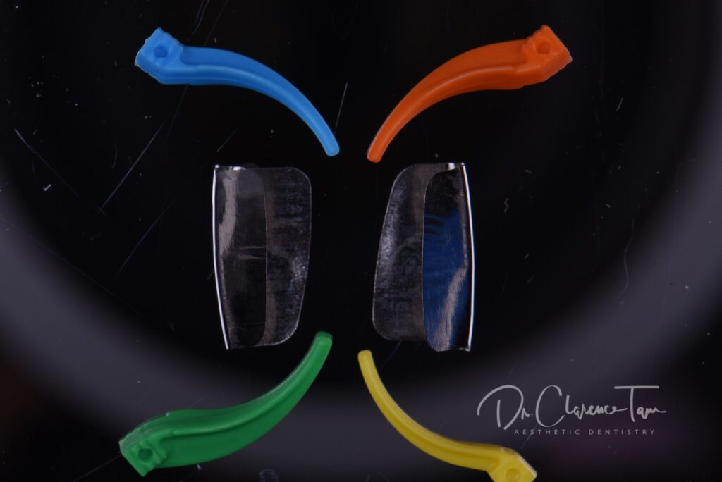 Garrison Fusion Anterior Matrix System for Class III Garrison Fusion ...