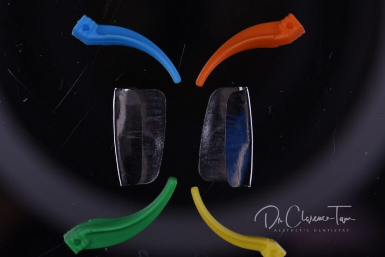 Garrison Fusion Anterior Matrix System for Class III Garrison Fusion ...