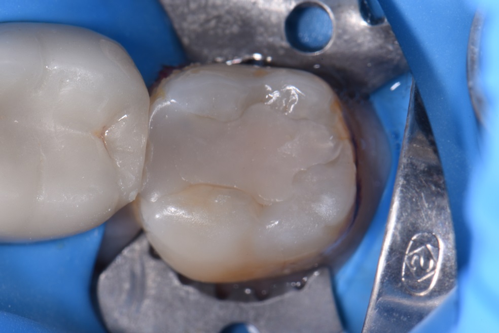 Flat Dental Anatomy with Character Flat Dental Anatomy with Character