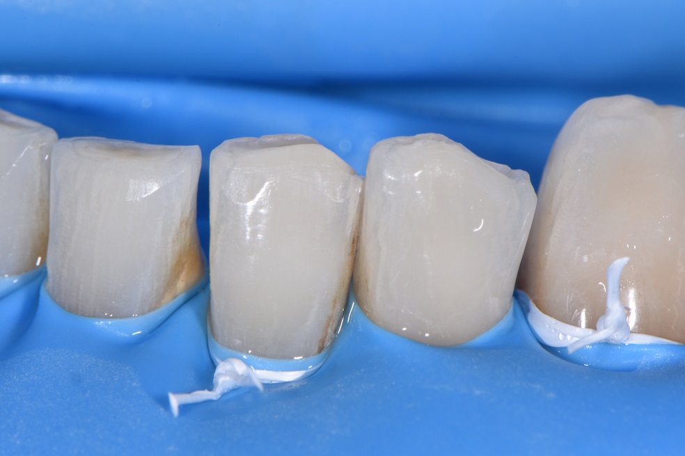 Composite Additions Composite Additions