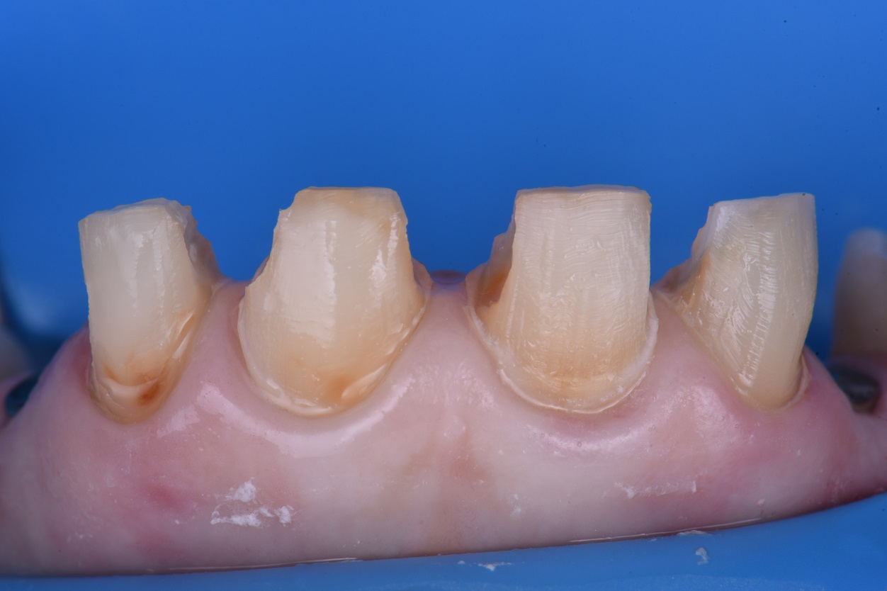 Tooth Axial Surfaces at Noah Anivitti blog