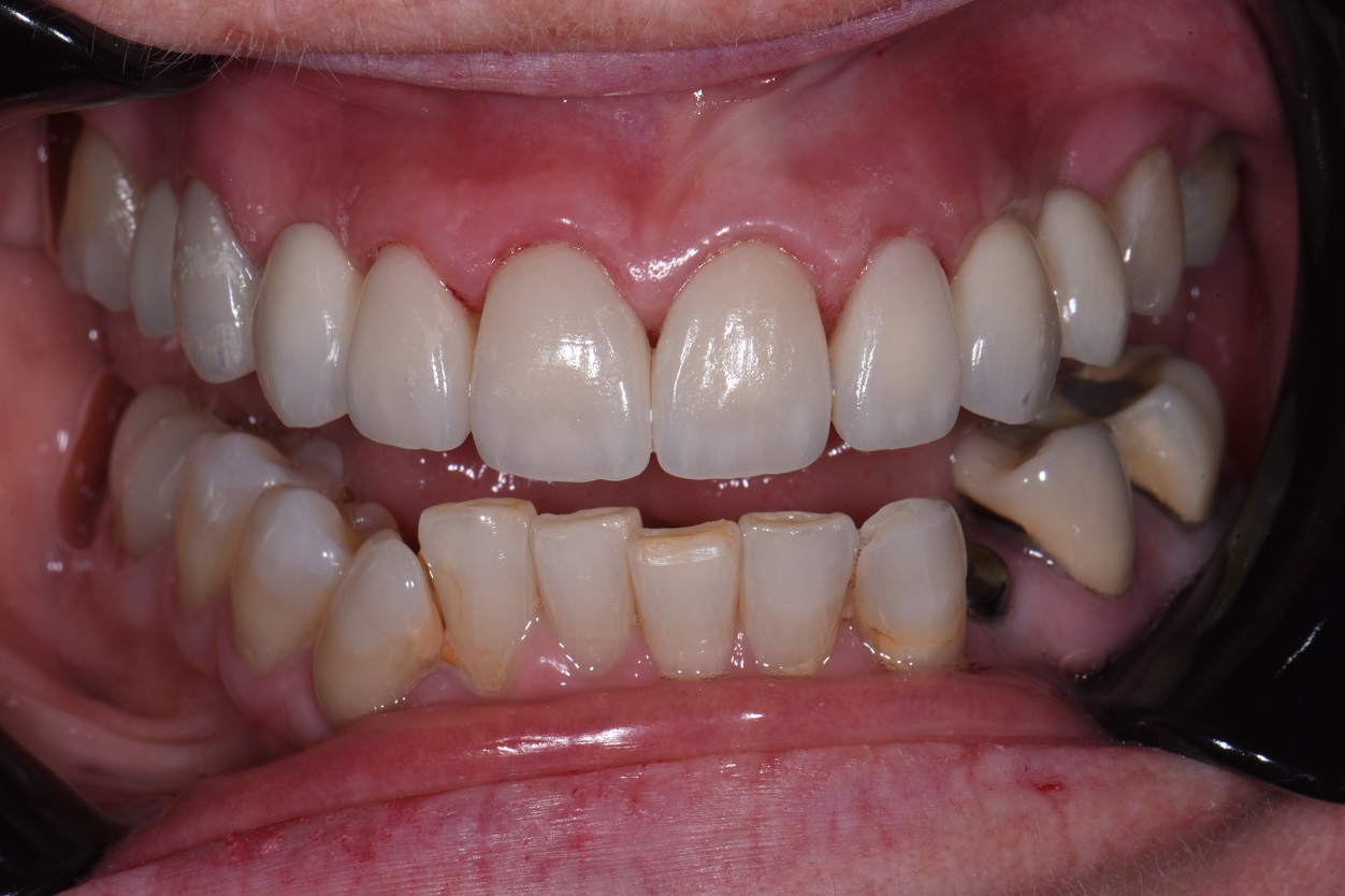 Smile Designer Pro | Digital Smile Design