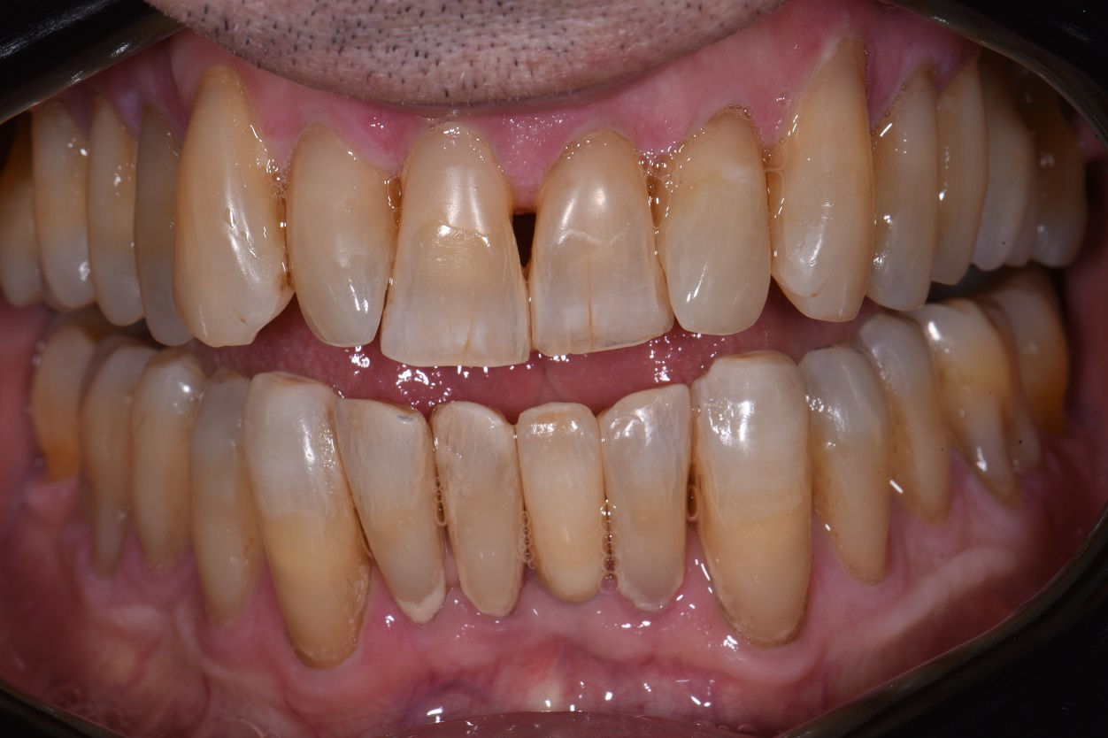 Geriatric Dentistry | Dentistry for Seniors Geriatric Dentistry ...