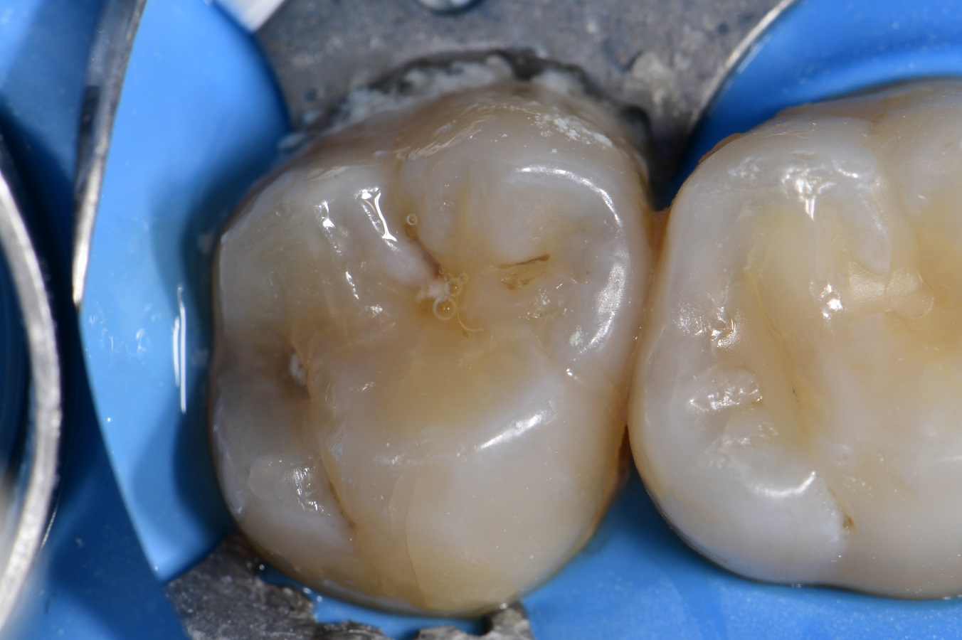 Sweet slot preparations Sweet slot preparations