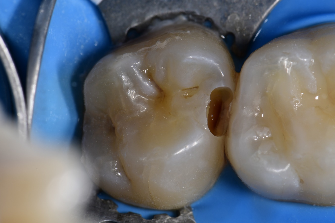 Sweet slot preparations Sweet slot preparations