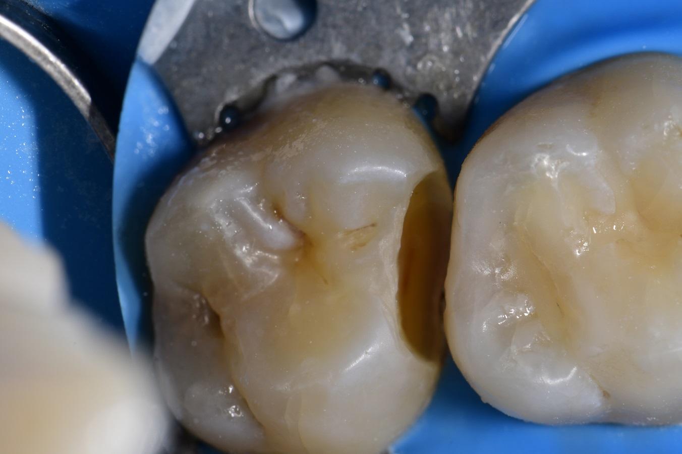 Sweet slot preparations Sweet slot preparations