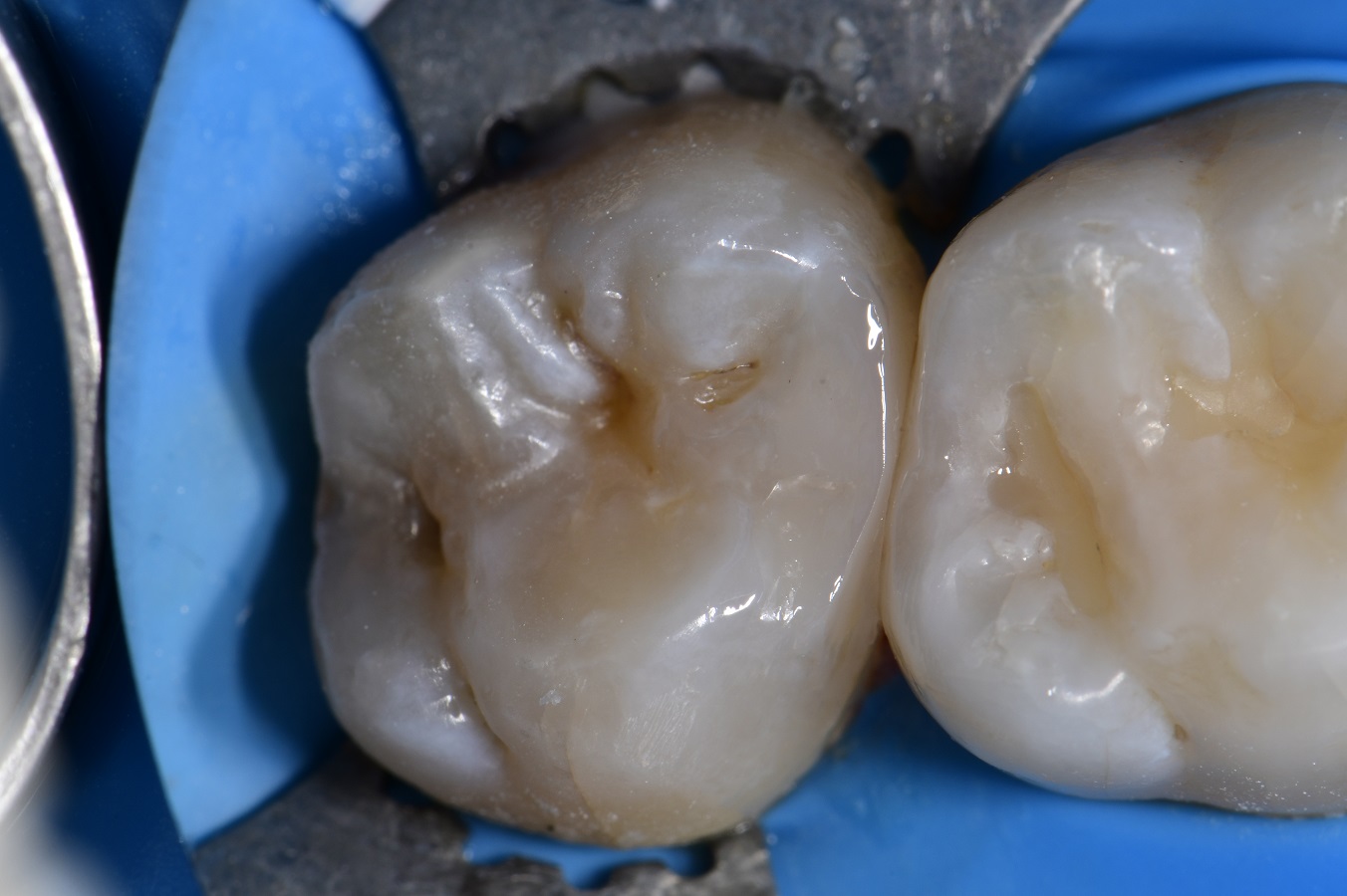 Sweet slot preparations Sweet slot preparations