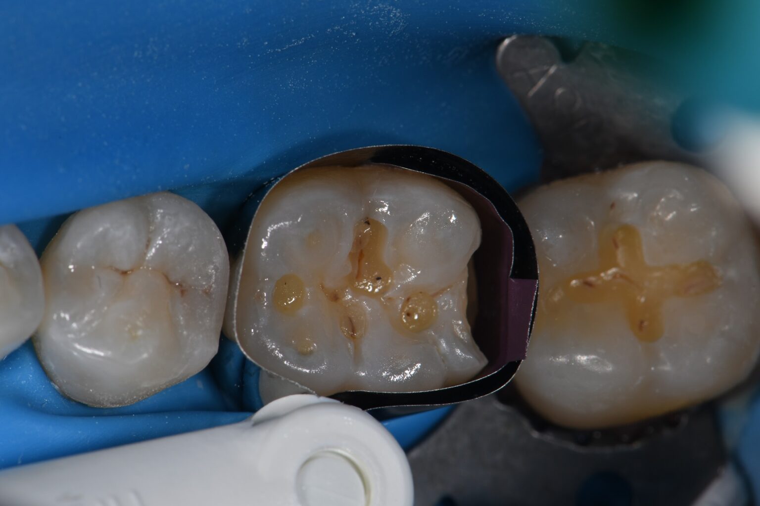 Style Italiano MicroLayering Style Italiano MicroLayering