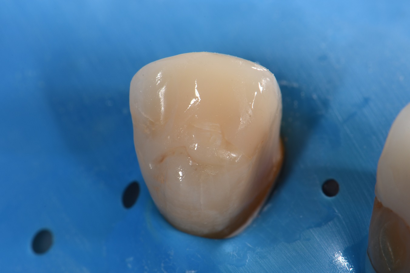 Multisurface composite reconstruction