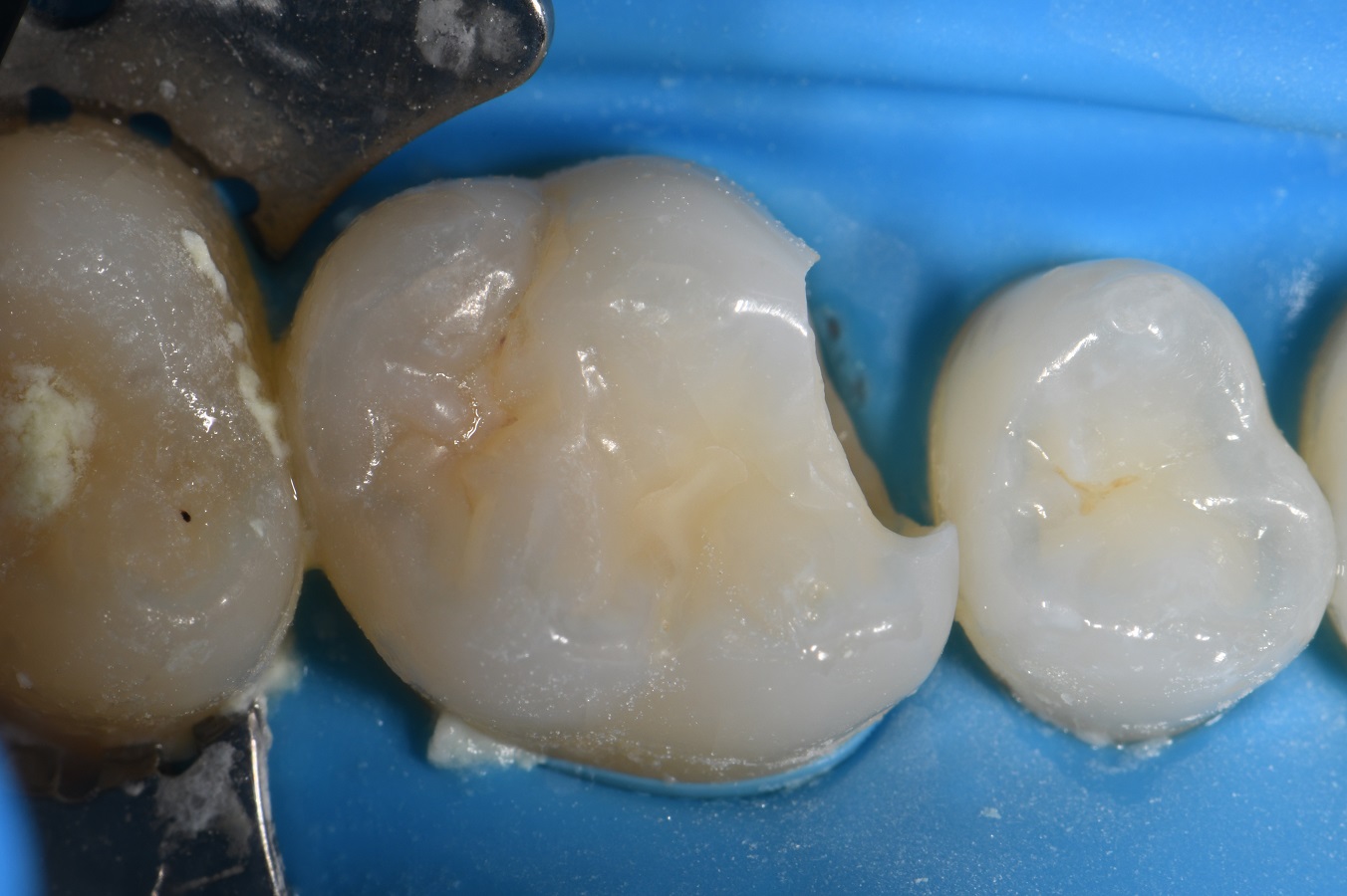 Invisible Slot Restoration Invisible Slot Restoration