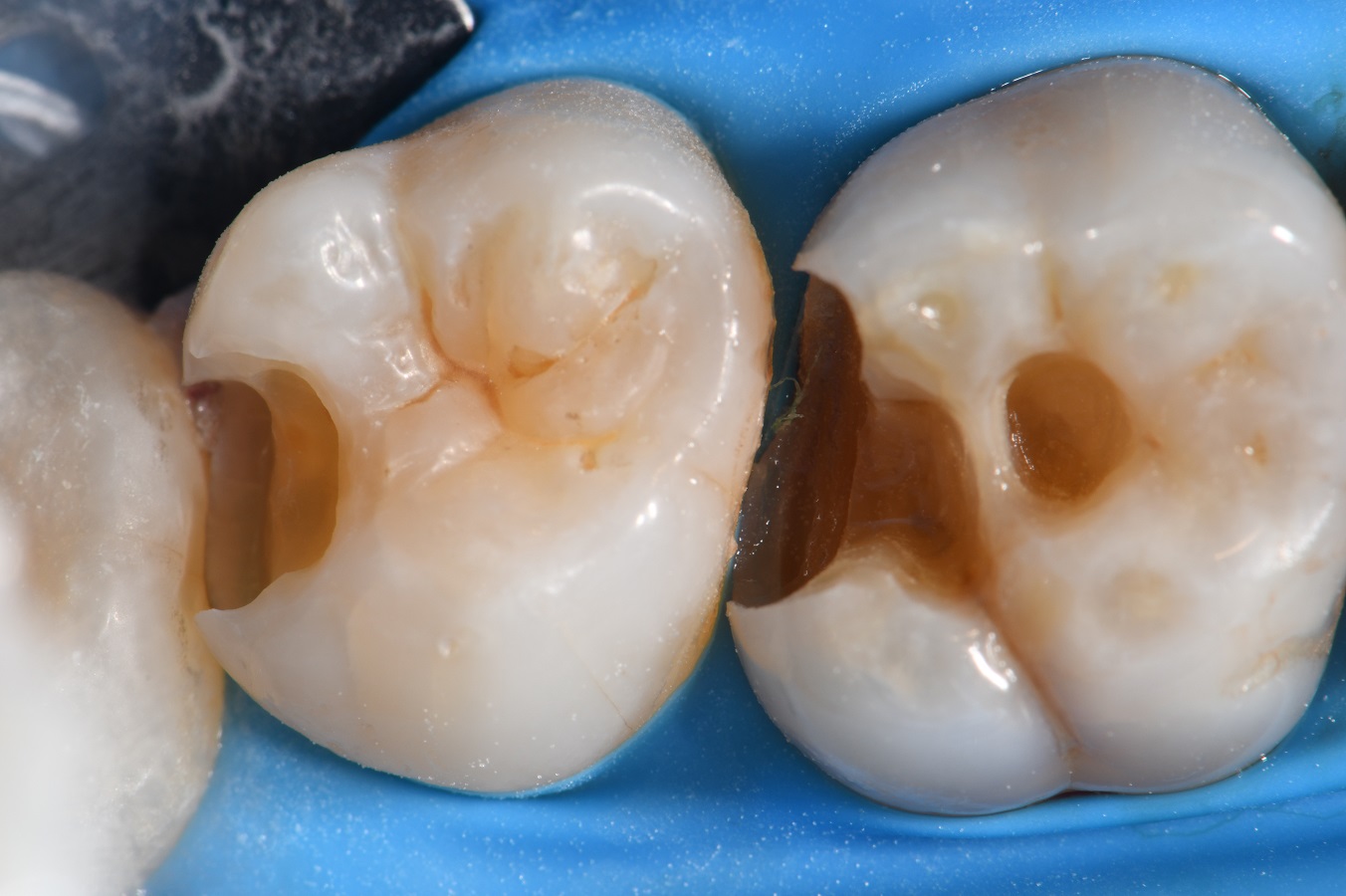 Cracks and Composite