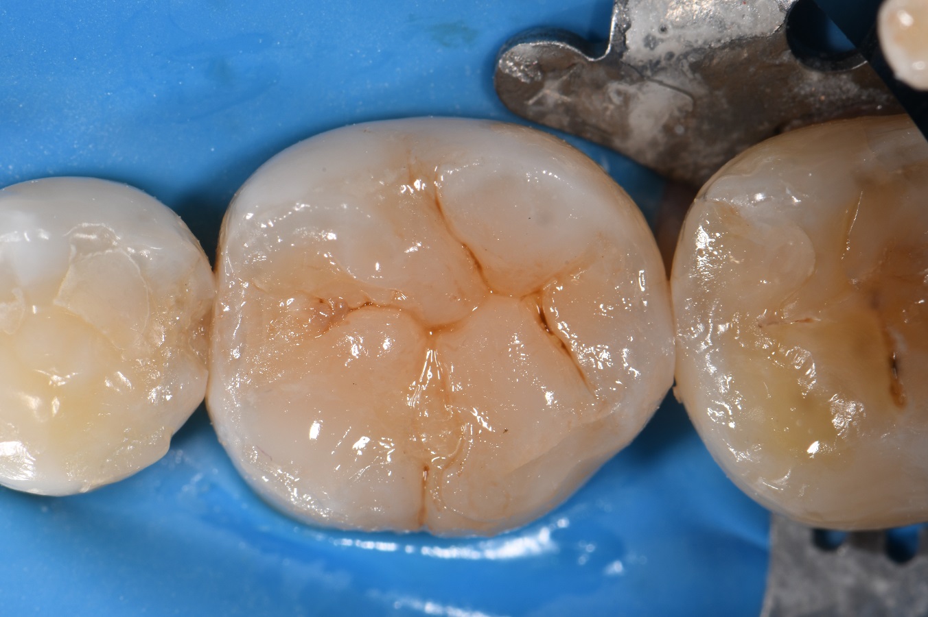 composite tints and a chameleon composite composite tints and a ...