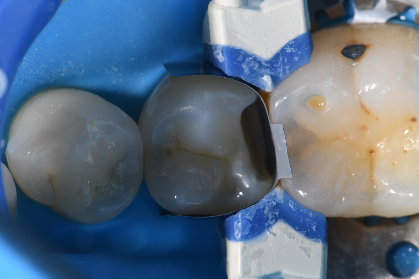 DentsplySirona CeramX Spectra ST