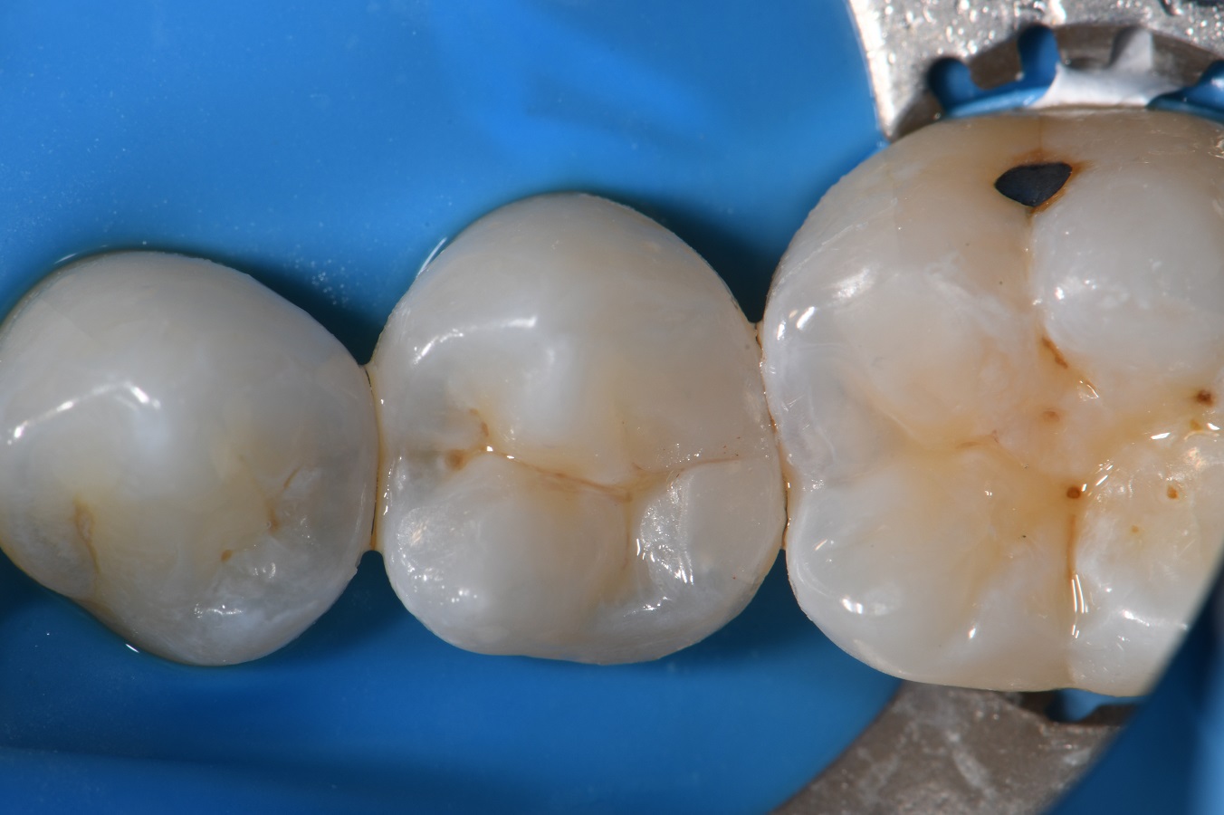DentsplySirona CeramX Spectra ST