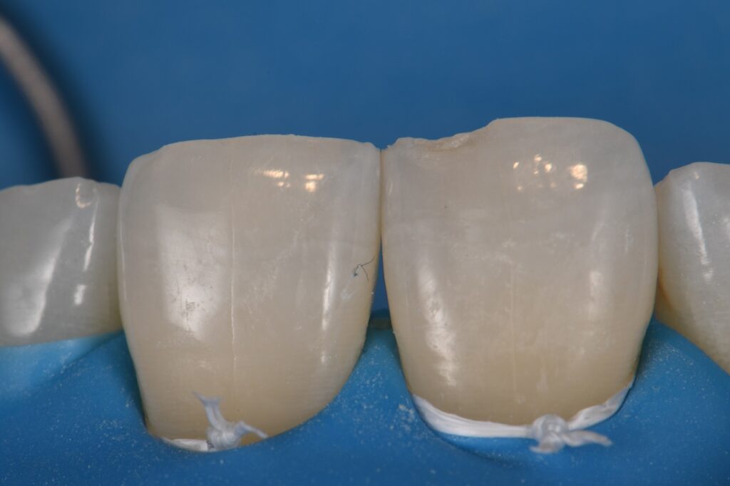 Invisible Composite Layering Invisible Composite Layering