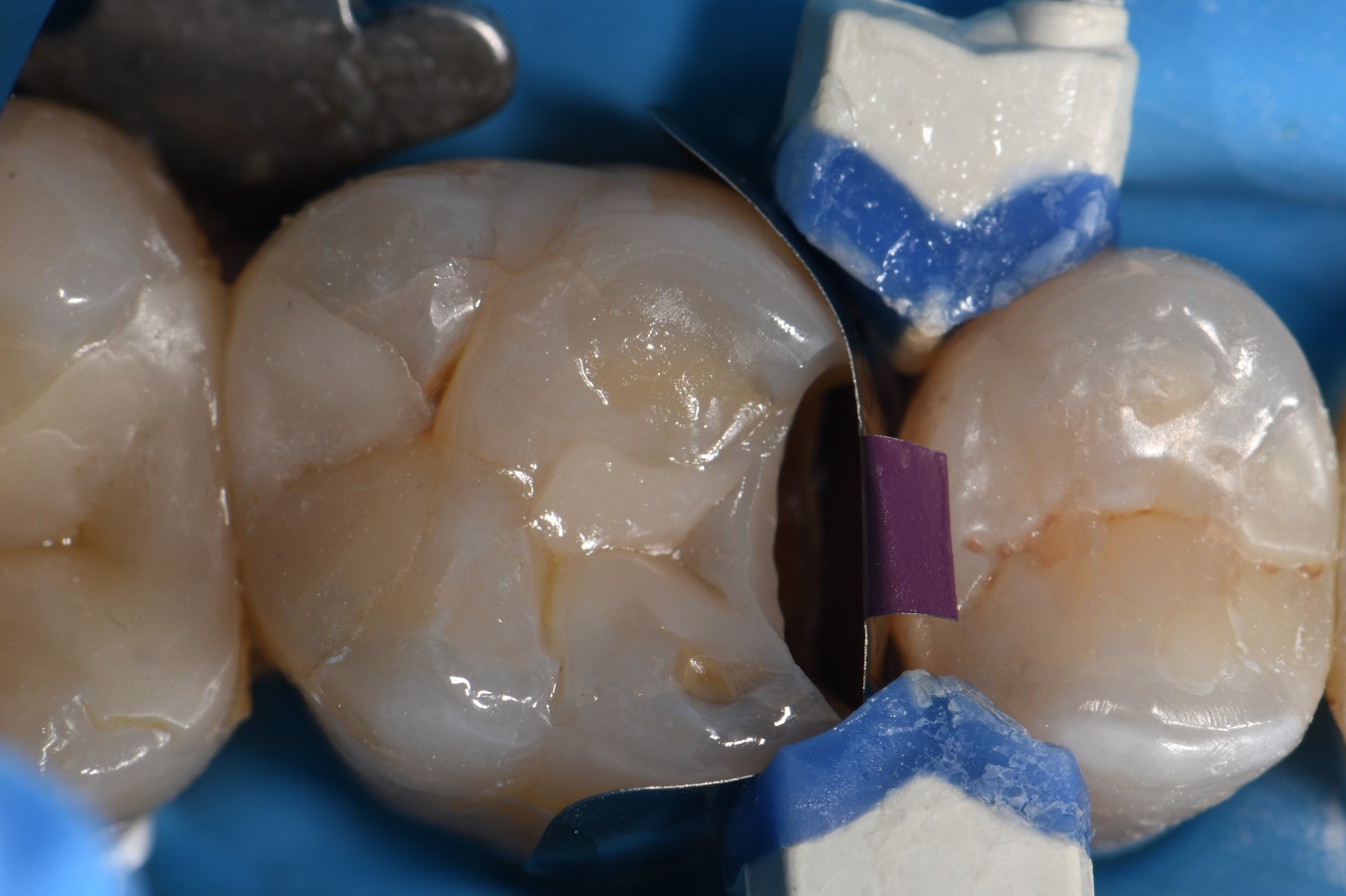 Invisible Slot Restoration