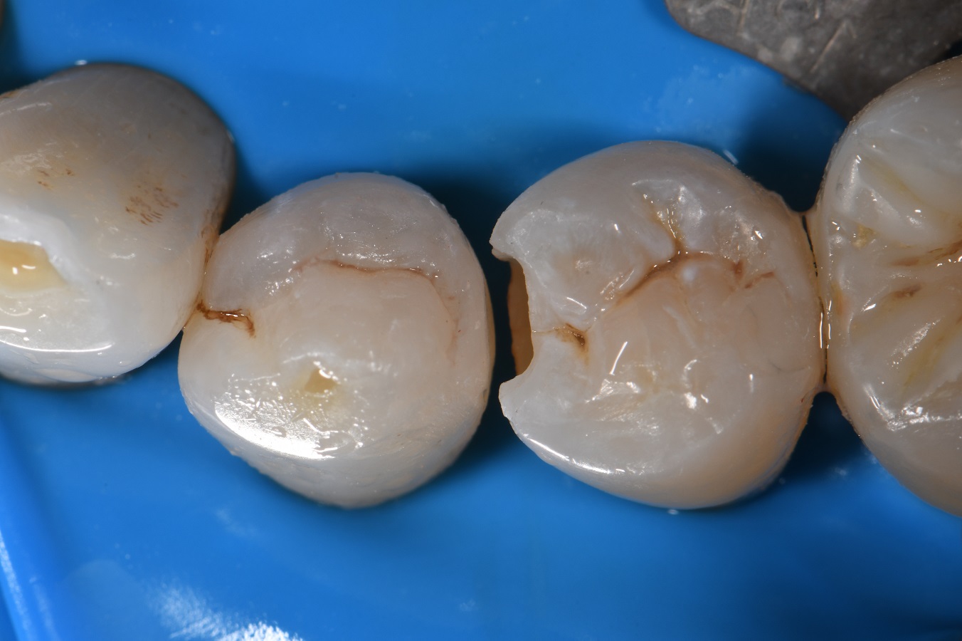 Matrix in Matrix | Back to back Class II Matrix in Matrix | Back to ...