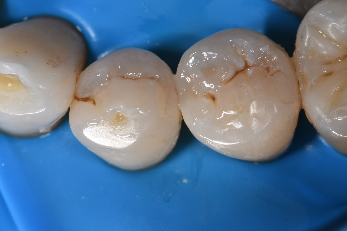 Matrix in Matrix | Back to back Class II Matrix in Matrix | Back to ...