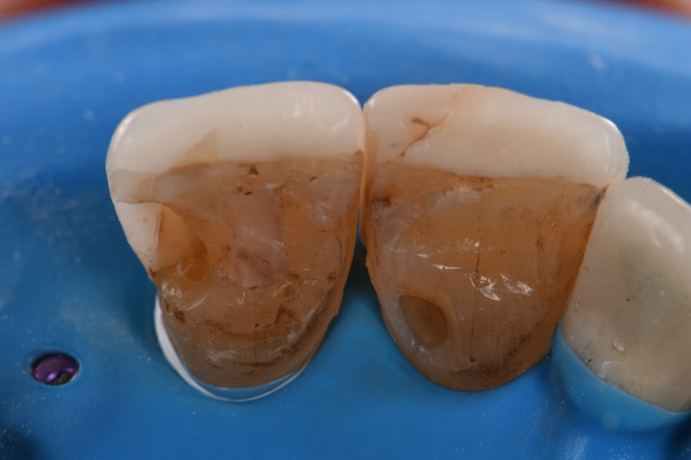 Multisubstrate dental adhesion Multisubstrate dental adhesion