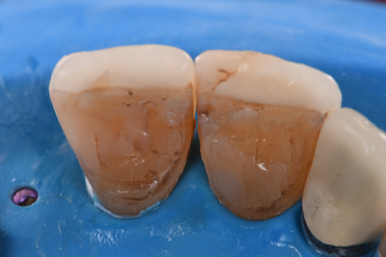 Multisubstrate dental adhesion Multisubstrate dental adhesion