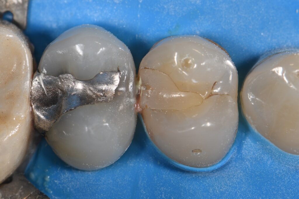 Using Garrison Strata-G over Compositight 3D Fusion