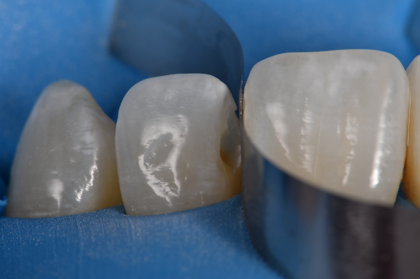 Class III Supercomposite