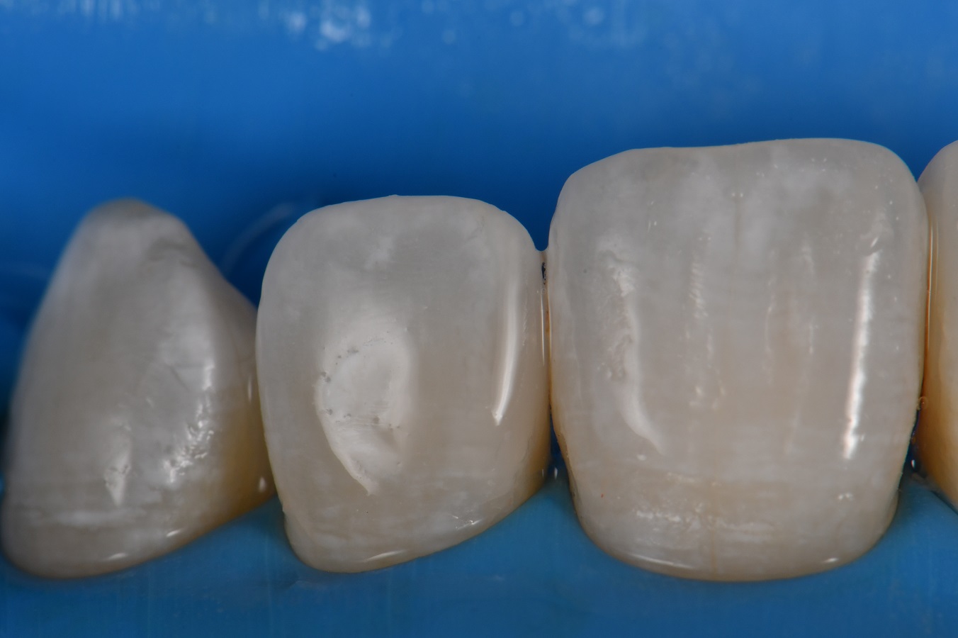 Class III Supercomposite