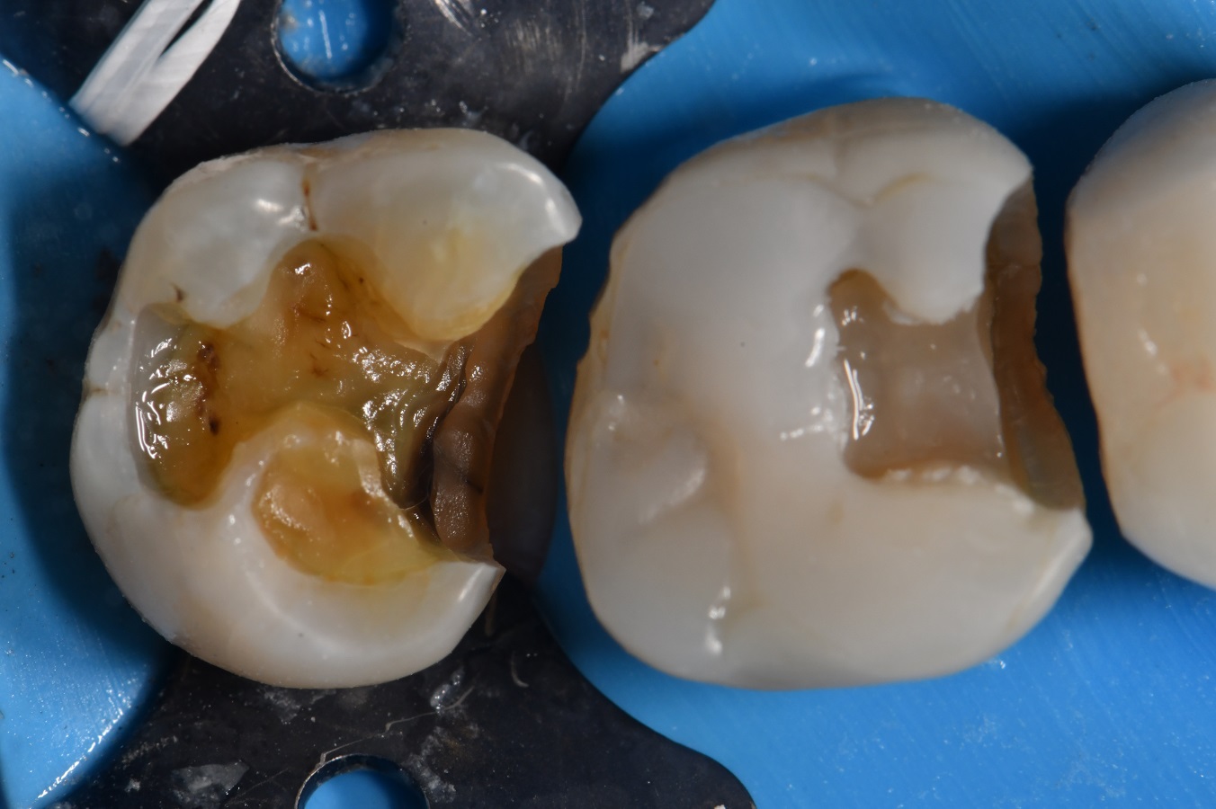 Rebonding new composite to old composite