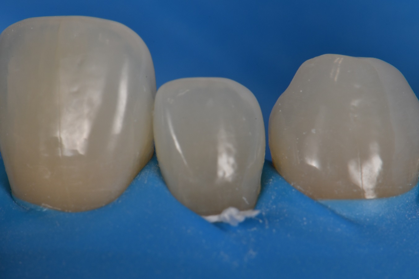 Generating translucency and window effects in a composite veneer