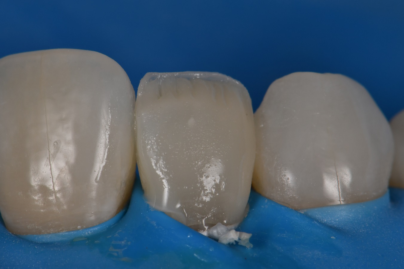 Generating translucency and window effects in a composite veneer