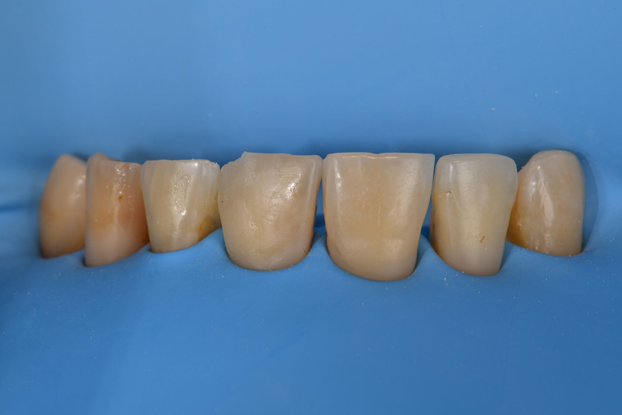 small simple composite layered restorations