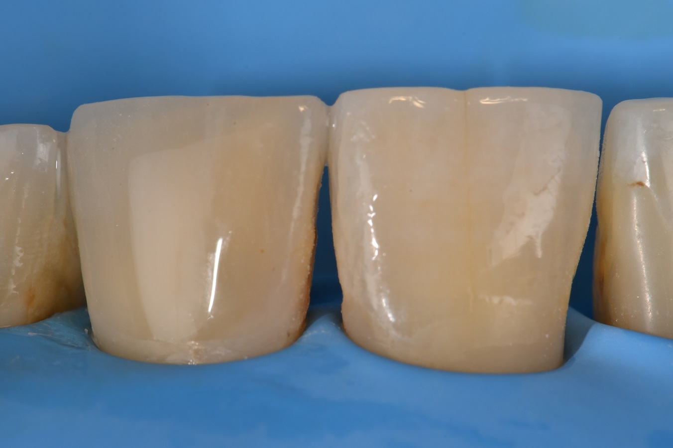 small simple composite layered restorations