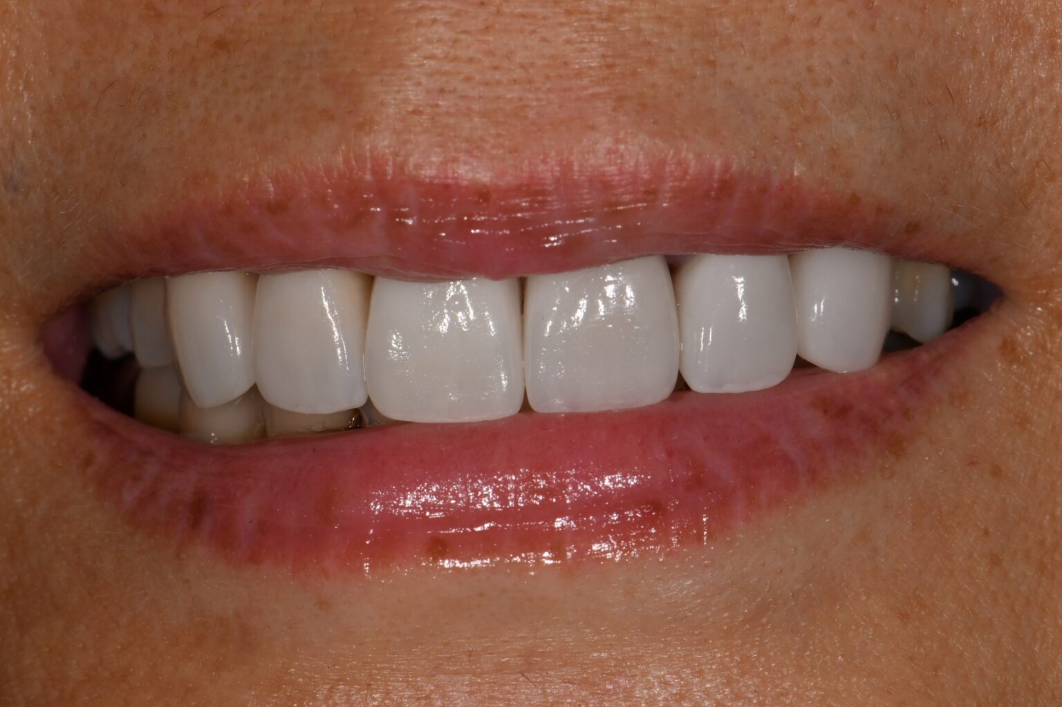 Social Six Smile Makeover