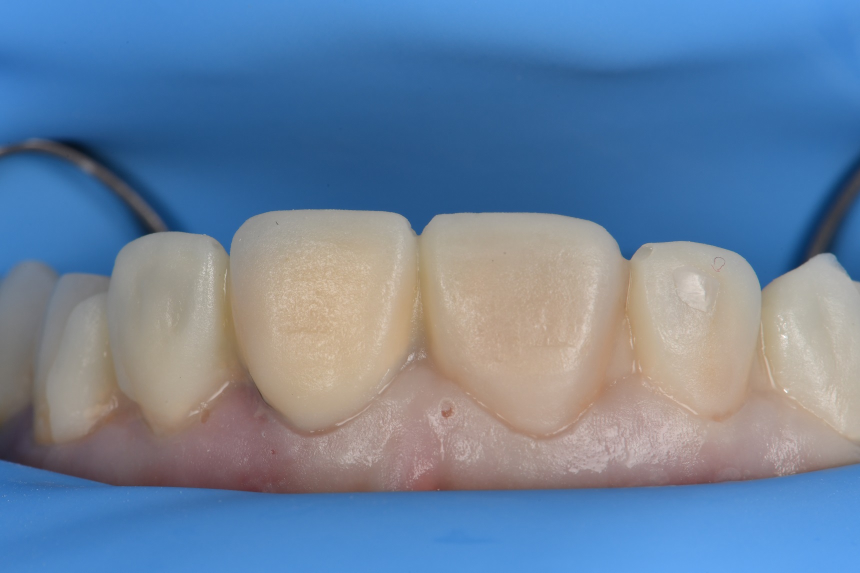 APT Technique for Controlled Preparations