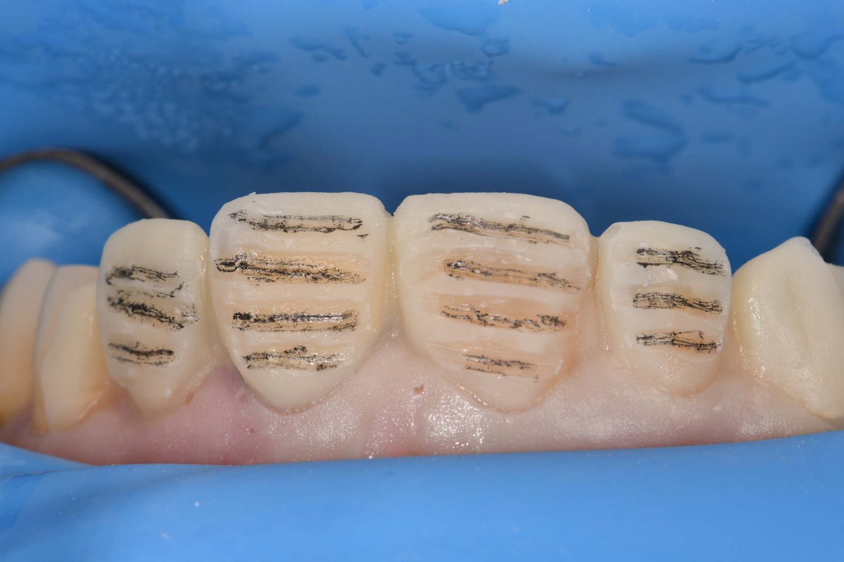 APT Technique for Controlled Preparations