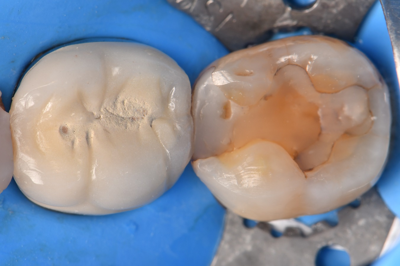 Building a Biobase on minimal residual structure