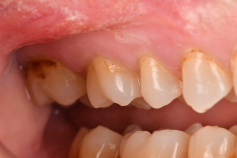 Class V Mayhem with GC Gaenial Achord