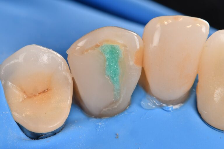 Garrison Varistrip how to use