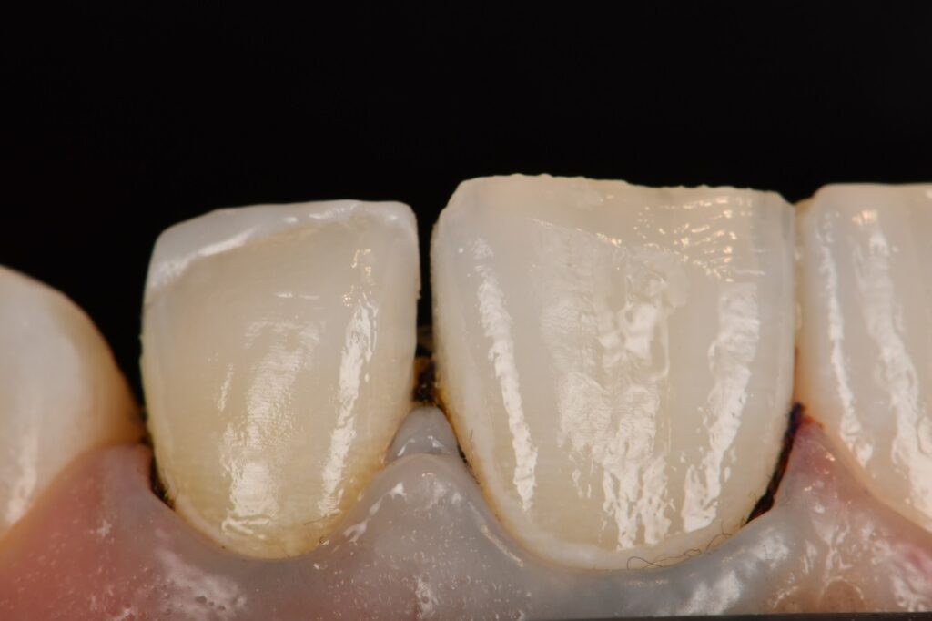 Composite Artistry and Texture