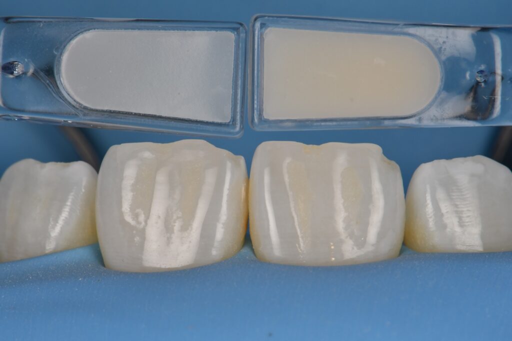 Dehydration and Edge Bonding Considerations